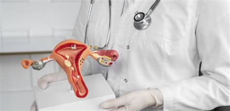 CandidÍase O Que é Causas Sintomas Pomadas Tratamento E Prevenção