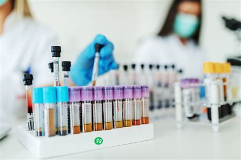 전염성 바이러스확산 테스트 및 예방 세계 전염병 비상 조치 및 격리 Stem 주제에 대한 스톡 사진 및 기타 이미지 Stem