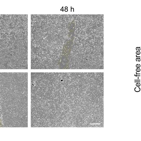 Assessment Of Cell Motility By Scratch Assay In The Wild Type Wt And