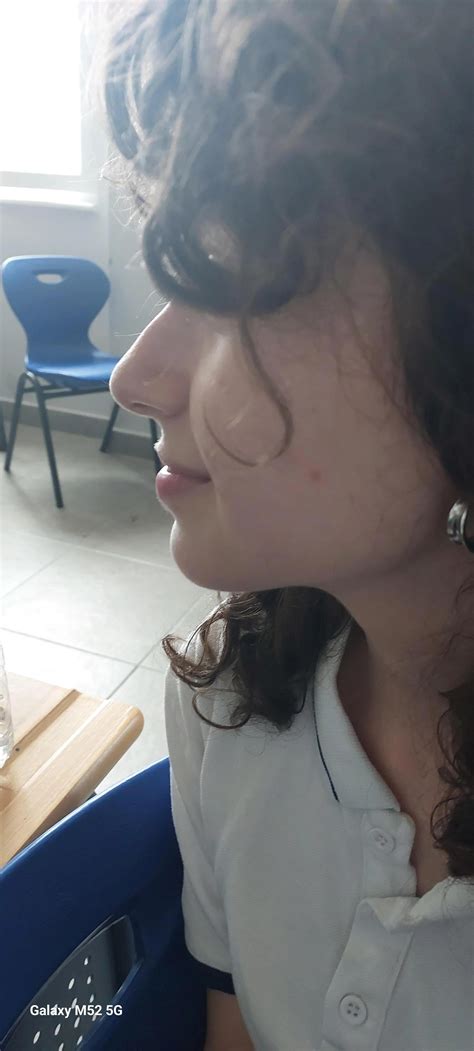Please Rate Nose R Noses