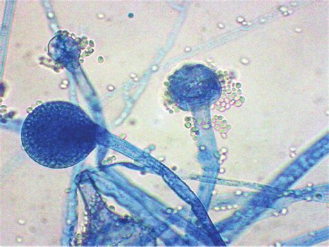 Mucor Species Microscopic Morphology In Culture Lactophenol Cotton