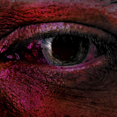 Conj Dog Conjunctivitis