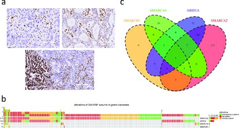 A Three Immunohistochemical Patterns Of Attenuated Swi Snf Subunits In Download Scientific
