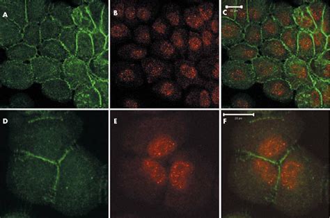 Axin Expression Pattern And Subcellular Localisation In Tumour Cell