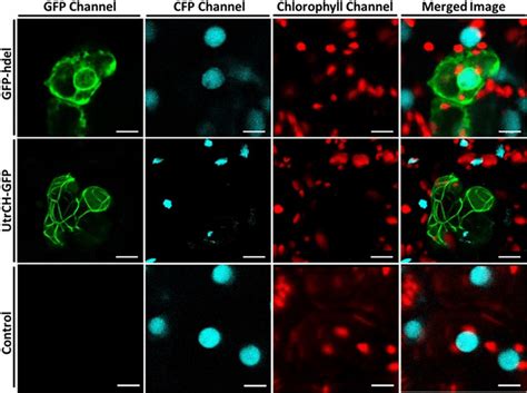 Subcellular Localization Of Endoplasmic Reticulum Targeted Gfp Download Scientific Diagram