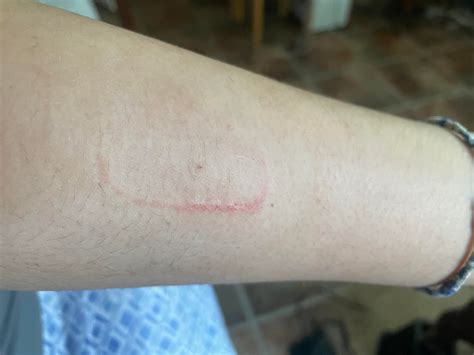 Ways To Fix Dexcom App Not Pairing With Transmitter R Dexcom