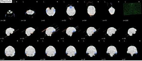 Epi Reference In Fmriprep Visual Report Error Software Support Neurostars
