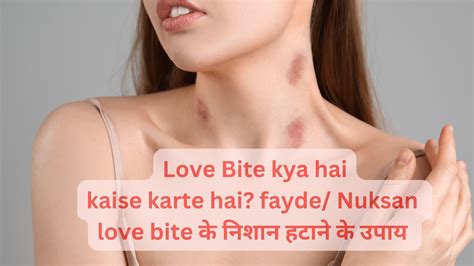 लव बाइट क्या और कैसे होता है मतलब Love Bite Meaning In Hindi