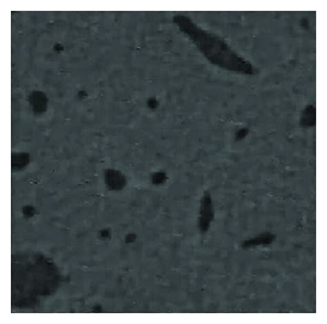 improved compressed sensing‐based algorithm for sparse‐view ct image reconstruction zhu 2013