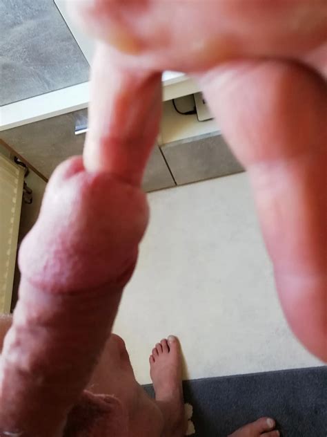 Dialator 28 Pics XHamster