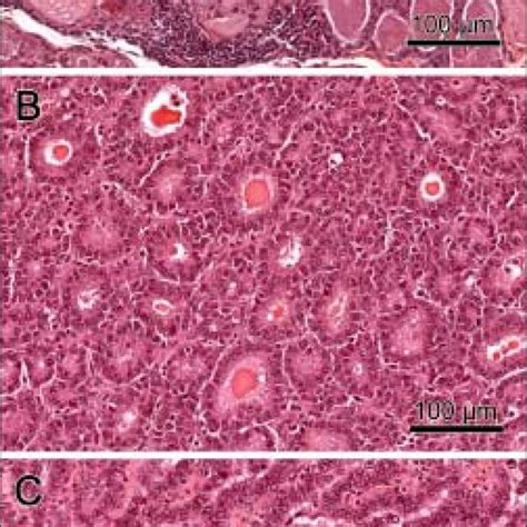 Panel Of Spontaneous Mammary Tumors Arising In Three Parous Fvbncr