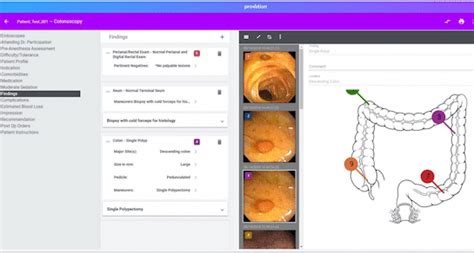Physician Documentation Provation