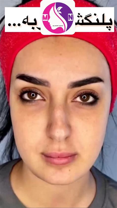 ‎ماندانا ناصری راد‎ Drmandananaserirad • Instagram Photos And Videos