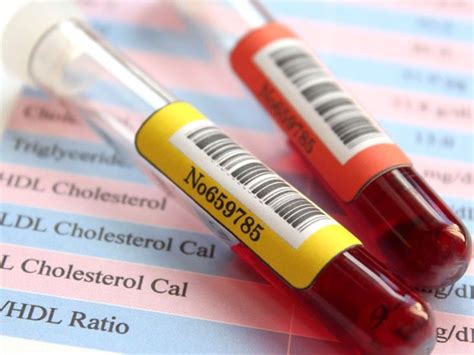Xét Nghiệm Cholesterol Lipoprotein Tỷ Trọng Cao Hdl Là Gì
