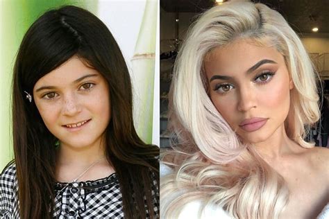 Kylie Jenner Before Plastic Surgery The Beauty Moguls Early Days