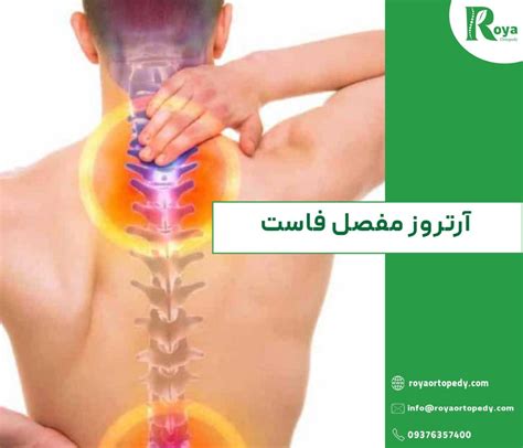 آرتروز مفصل فاست ستون فقرات چیست؟ علائم 8 درمان موثر