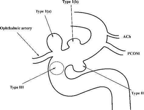 Paraclinoid Anatomy