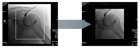 Benefits Ultimax I X Ray Canon Medical Systems Usa Benefits Ultimax I X Ray Canon Medical Systems Usa