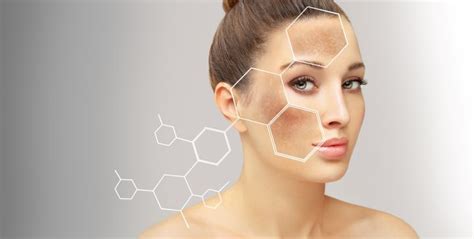 Skin Hyperpigmentation What Causes The Disorder — Arclantic