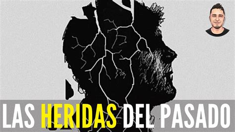 El Origen De La Ansiedad Y Sus 5 Causas Psicólogo Kevin López