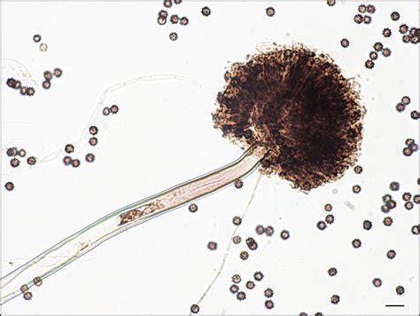 Aspergillus Conidiophores