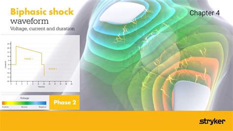 Ramoncito Bayas Rn On Linkedin 3d Biphasic Defibrillation Animation Chapter 4