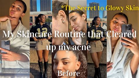 My Skincare Routine For Clear Glowy Skin How I Cleared My Acne Youtube
