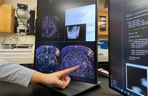 Deep Learning To Improves Ultrasound Localization Microscopy