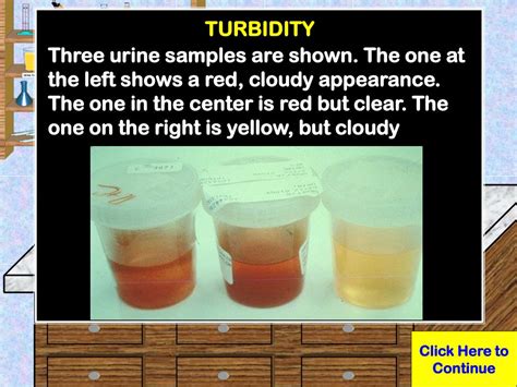 Turbid Urine 中文 Turbid Urine Manilash