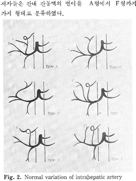 Figure 2 From Normal Variation Of Hepatic Artery Semantic Scholar