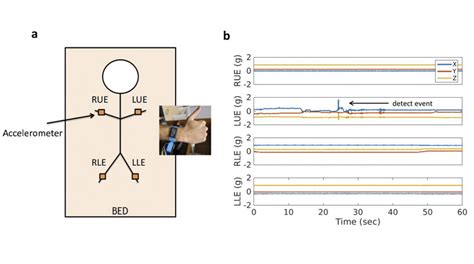 Use Of Accelerometry For Long Term Monitoring Of Stroke Patients Ieee Journal Of Translational