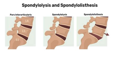 Module 5 Module 6 Flashcards Quizlet