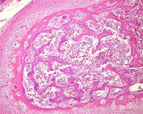 Endochondral Ossification Of Immature Bone Photograph By Jose Calvo