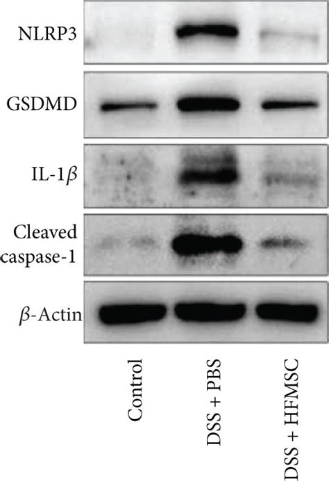 Hfmscs Reduced Pyroptosis In Vivo To Detect The Impact Of Hfmscs On