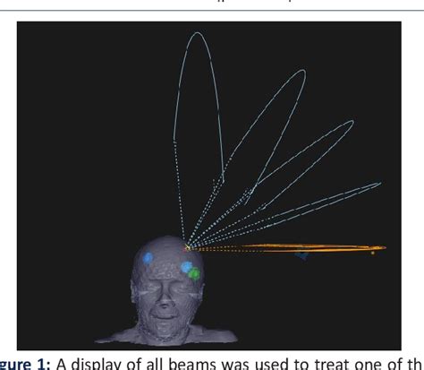 Figure 1 From Evaluation Of Dosimetry Metrics In Single Isocenter Multiple Targets And Single