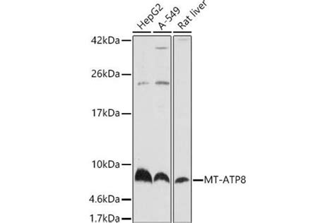 Mitochondrially Encoded Atp Synthase 8 Antibodies