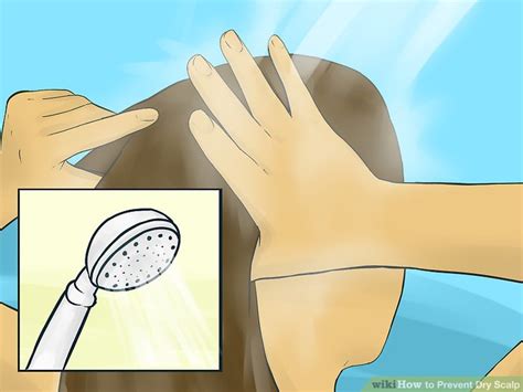 3 Ways To Prevent Dry Scalp WikiHow Health