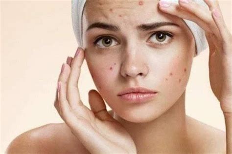 Staphylococcus Aureus Dermatologistas Explicam Os Riscos Da