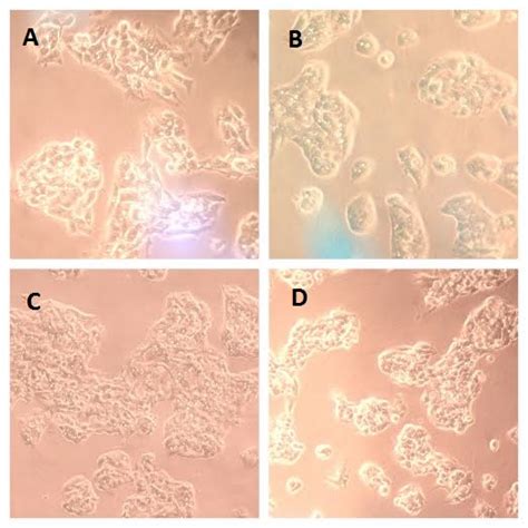 Can Someone Help With Hepg2 Cells Morphology