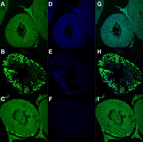 Germ Cell Apoptosis Gca Assessed By Tunel Immunohistofluorescence