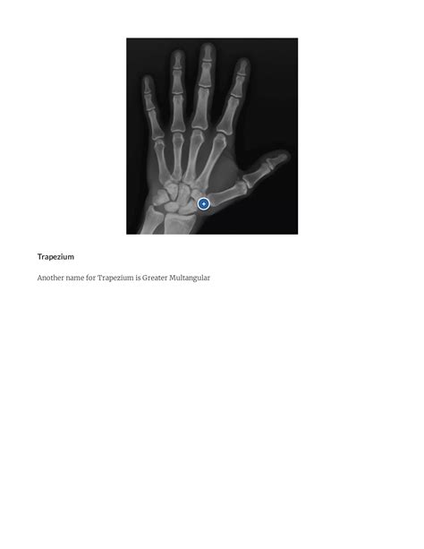 Radiology Anatomy Of The Hand And Wrist Pdf