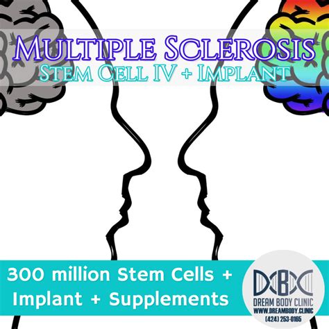 Multiple Sclerosis Stem Cell Treatment Dreambody Clinic