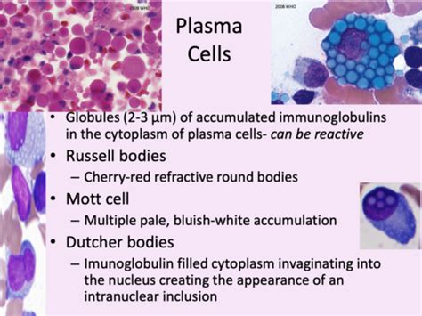 Plasma Cell Neoplasms Flashcards Quizlet