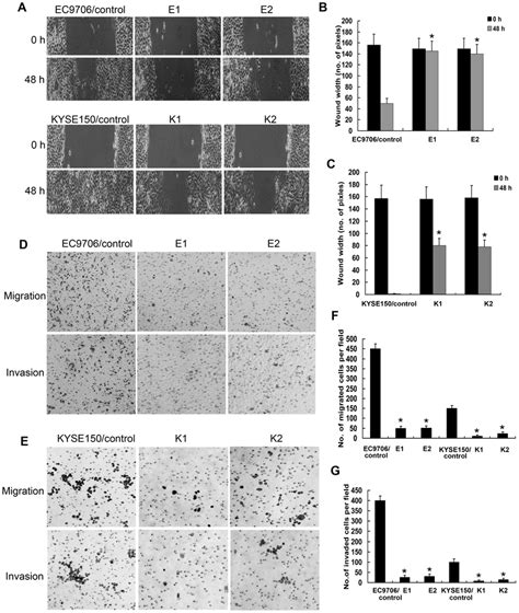 Knockdown Of Iqgap1 Expression Inhibits The Migration And Invasion Of