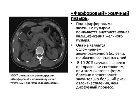 Лучевая диагностика печени поджелудочной железы желчного пузыря презентация онлайн