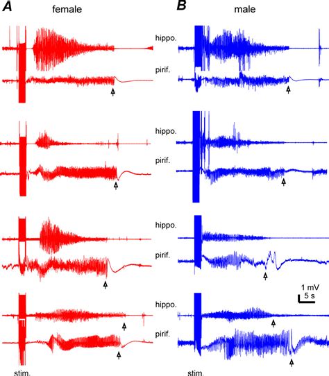 Sex Influences On Hippocampal Kindling Induced Seizures In Middle Aged Mice Heliyon