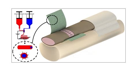 Electrospun Nanofibrous Membranes For Preventing Tendon Adhesion Acs Biomaterials Science