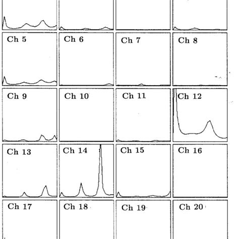 Electrode Array And Ecog Recordings A Electrode Array On The