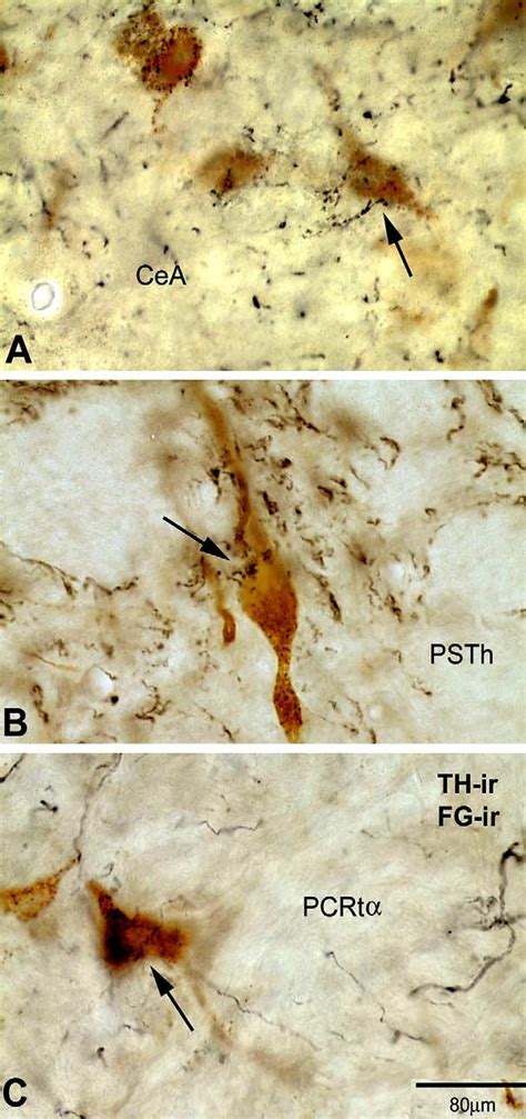 Distribution Of Neurons Projecting To The Trigeminal Motor Nucleus
