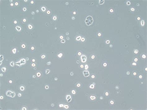 16 Questions With Answers In Min6 Cell Line Science Topic